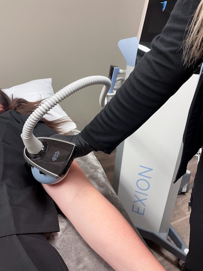 Exion Body Sculpting Treatment in Scottsdale & Phoenix, AZ